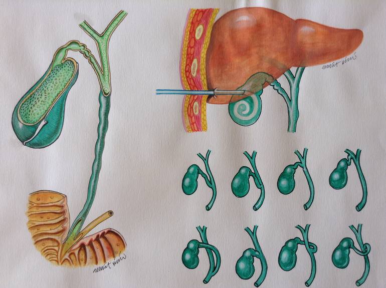 Gall Baldder Anatomy Painting by Murat Isci | Saatchi Art